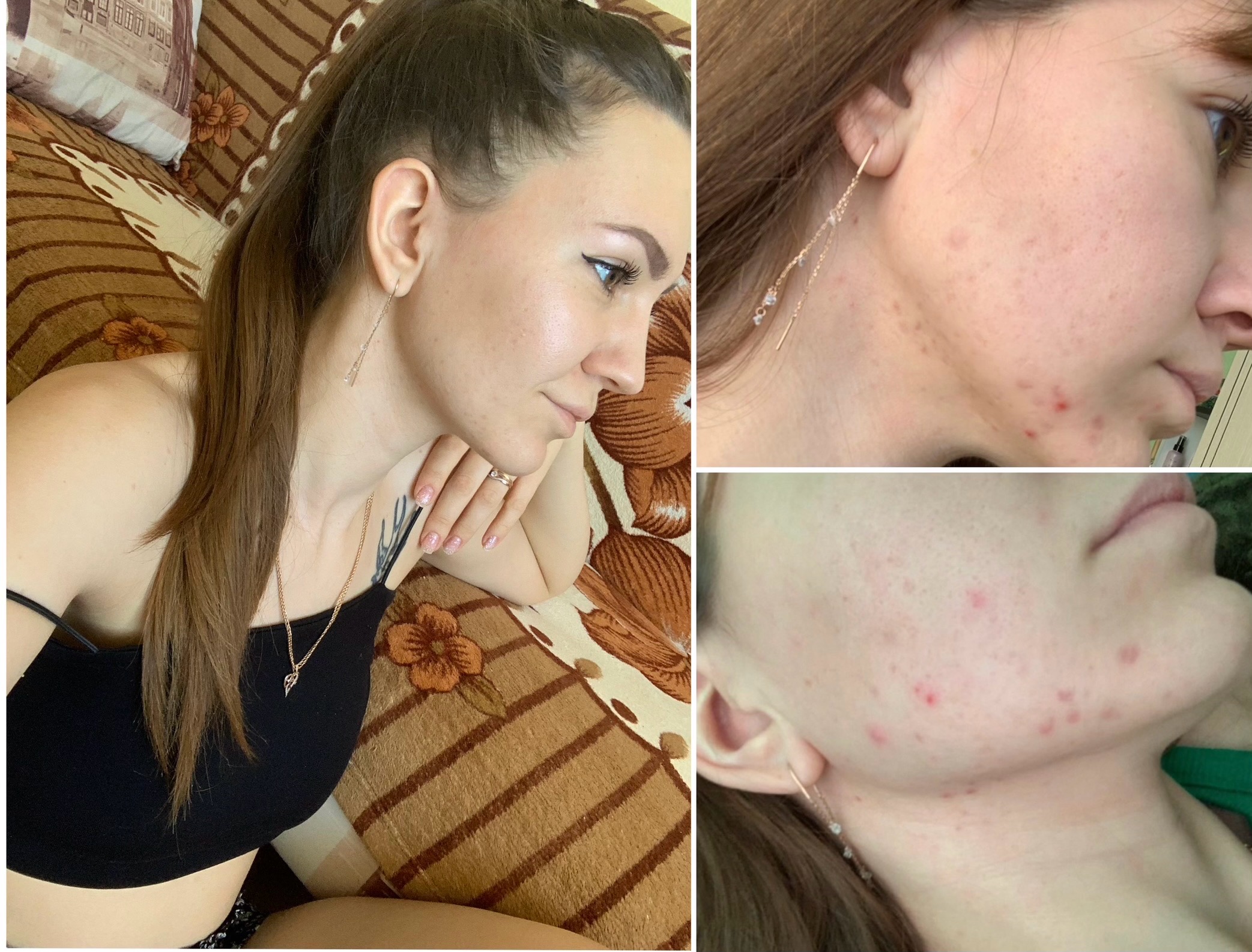 Detox Step 1 Plus — формула очищения кишечника купить в интернет ...
